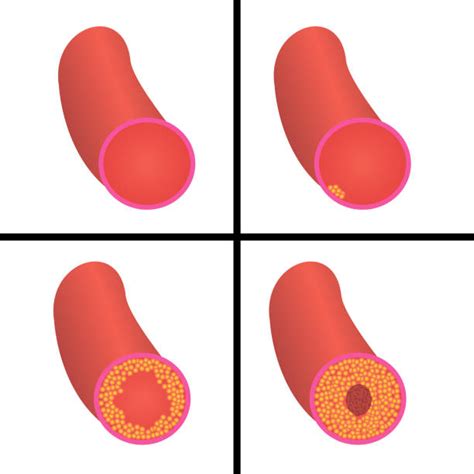 Lipid Illustrations Royalty Free Vector Graphics And Clip Art Istock