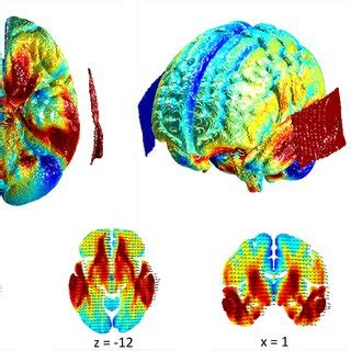 Modelling Of Predicted Electrical Fields Based On TDCS Stimulation Download Scientific Diagram