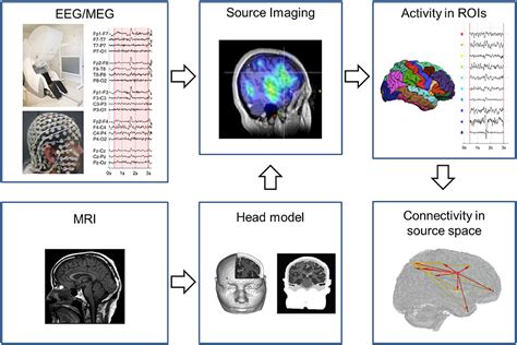 Frontiers Network Perspectives On Epilepsy Using Eegmeg Source Connectivity