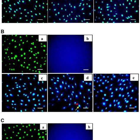 Nanoparticles Were Prepared By Nanoprecipitation Method The Prepared