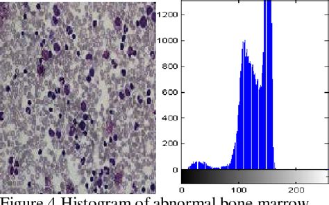 Figure 1 From Tumor Detection Using K Mean Clustering Algorithm Method