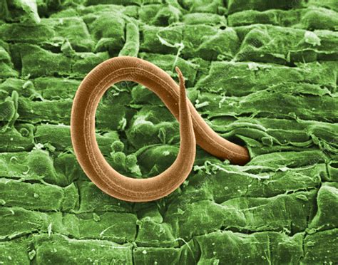 Root Knot Nematode Sem Stock Image C009 3426 Science Photo Library