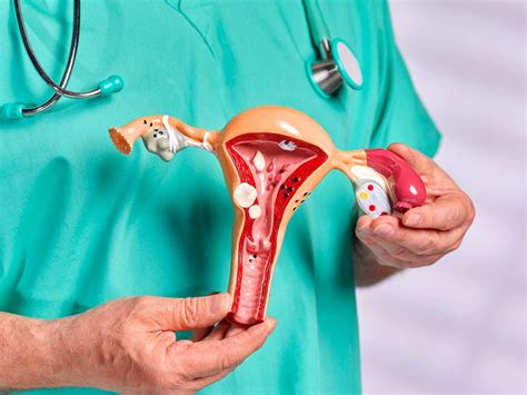 Uterine Prolapse Degrees