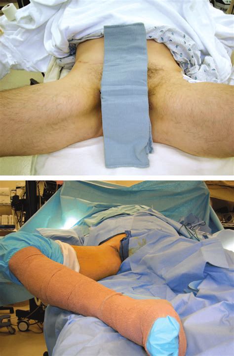 Intraoperative Demonstration Of Increase In Hip External Rotation After Download Scientific