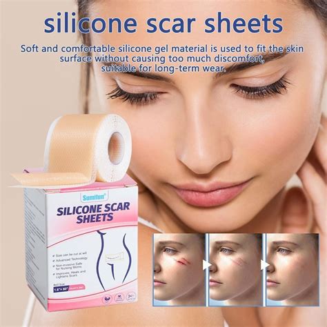 Scar Away Sheet Silicone Scar Strip Silicone Tape Roll Silicone Scar
