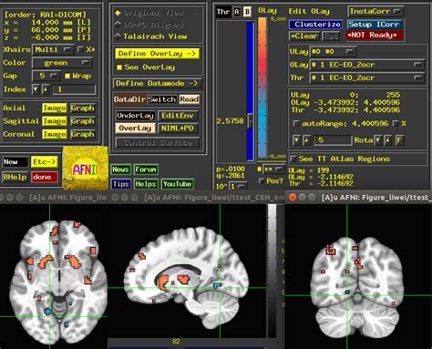 How Create A New Colormap Afni Message Board Afni Discuss Message Board