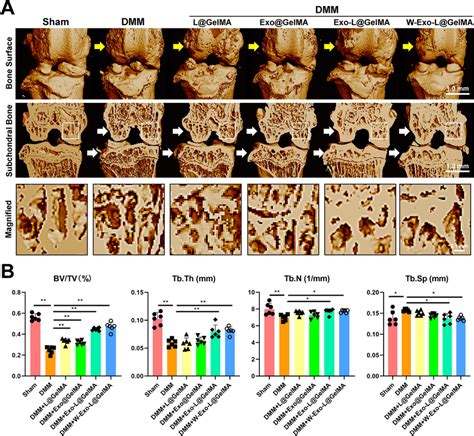 W Exo L Gelma Inhibits Osteophyte Formation And Subchondral Bone Loss Download Scientific