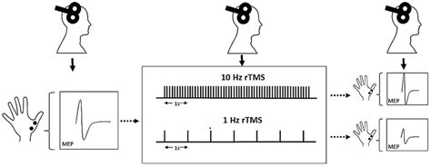 Basic Protocols And Main Effects Induced By Rtms Mep Motor Evoked