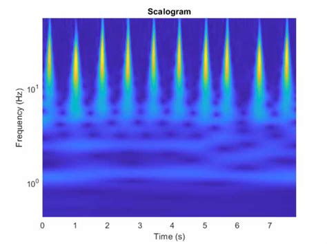 Ecg Scalogram Using Cwt Download Scientific Diagram