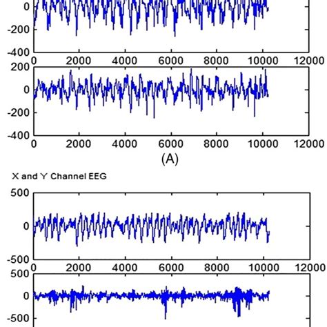 Illustration Of Focal And Nonfocal Eeg Signals Download Scientific Diagram