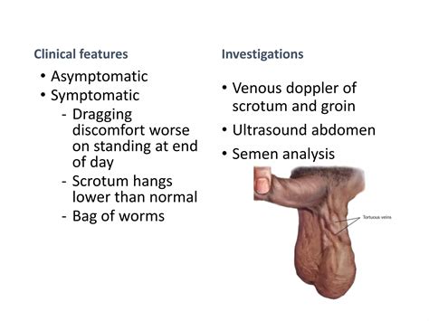 Scrotal Swelling Pptx