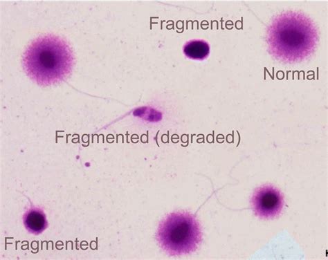 Sdfa Kit Dna Fragmentation Assay Kit