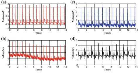 3 A The Clear Ecg Signal And The Ecg Signal With Simulated Noise C The