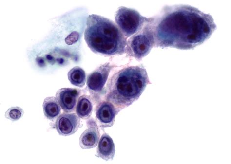 Cervical Cytology