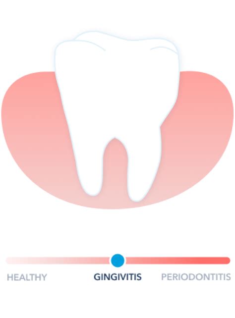 Helthy Gums Results Meridol®