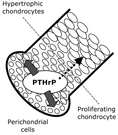 Cancer Induced Hypercalcemia Anticancer Research
