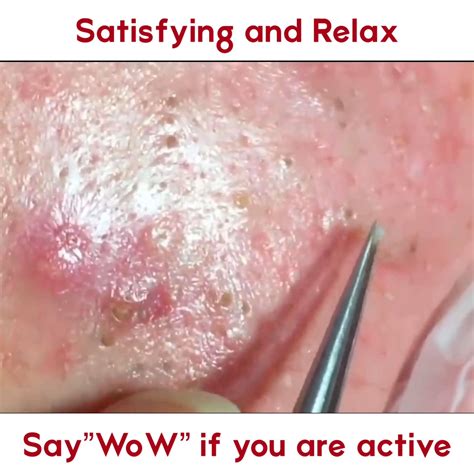 Cartoon Error Cartoon Error Added A New Photo