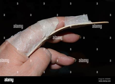 Finger Splint Hi Res Stock Photography And Images Alamy
