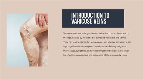 Ppt Varicose Veins Surgery Cost In Chennai Powerpoint Presentation