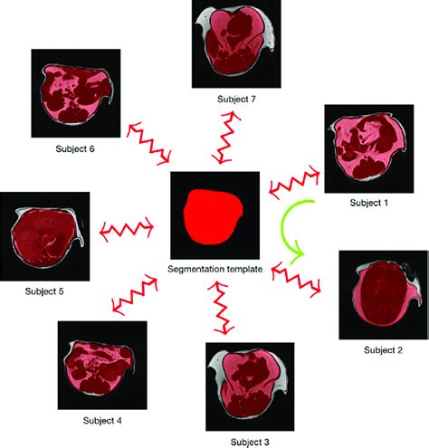 Example Mr Images Showing Data Augmentation Strategy We Introduced A Download Scientific