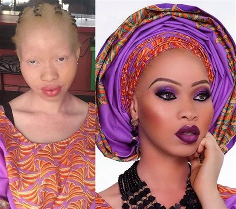 ვიზაჟისტებმა ალბინოსი გოგონა მაკიაჟის დახმარებით გარდასახეს ეს უბრალოდ დაუჯერებელია