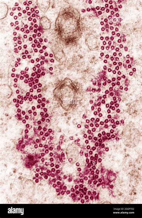 Colorized Cross Sectional Transmission Electron Micrograph Tem Of