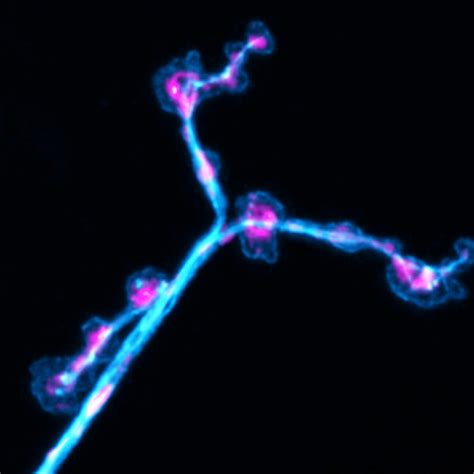 Neuronal Energy Metabolism The Macleod Lab