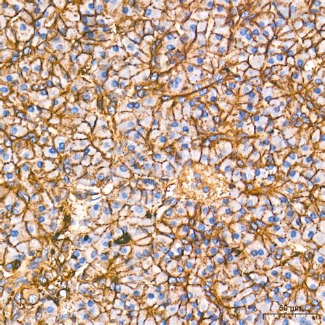 β Actin Mouse Mab Tag And 로딩 컨트롤 항체 Abclonal