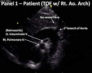 Pedicardiology Quiz Answers Quiz 19 Answer