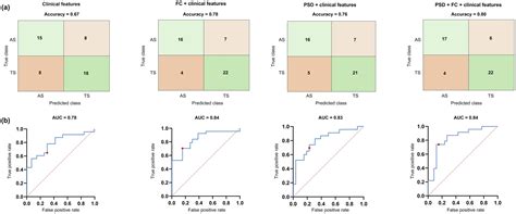 Combination Of Magnetoencephalographic And Clinical Features To Identify Atypical Self Limited