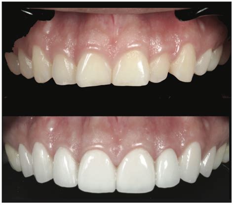 Three Dimensional Facial Scanning A New Paradigm Dentistry Today