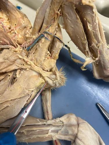 Lab Reproductive System🤰🍼👶 Flashcards Quizlet