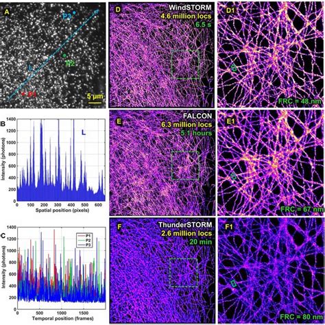 comparison of different algorithms for simulated dataset with bright