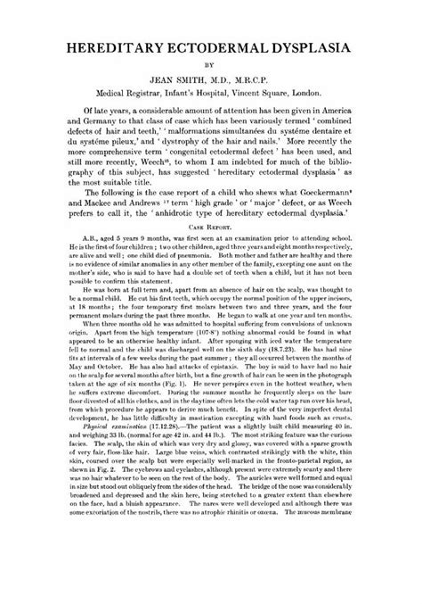 Pdf Hereditary Dysplasia Ectodermal Dysplasia Pdf · Hered Itariy Ectodermal