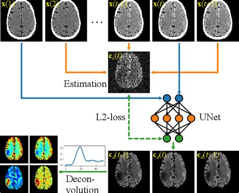 Figure 1 From Self Supervised Dynamic Ct Perfusion Image Denoising With