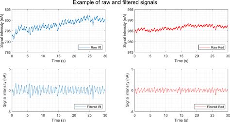 Figure 10 From Evaluating The Potential Of An Oral Based Bioguard To Estimate Heart Rate Using