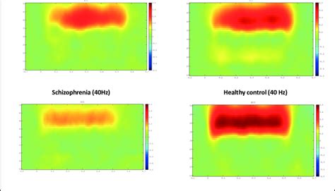 Time Frequency Distribution Characteristics Of Assrs Phase Locking