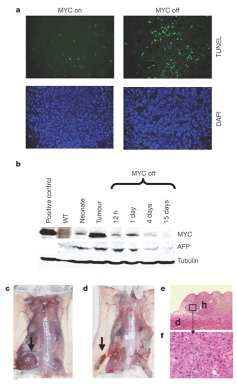 Myc Inactivation In Liver Tumours Results In Rapid Tumour Regression Download Scientific