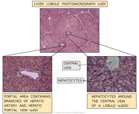 Liver Histology Sydney Norwest Gastroenterology Polypectomy