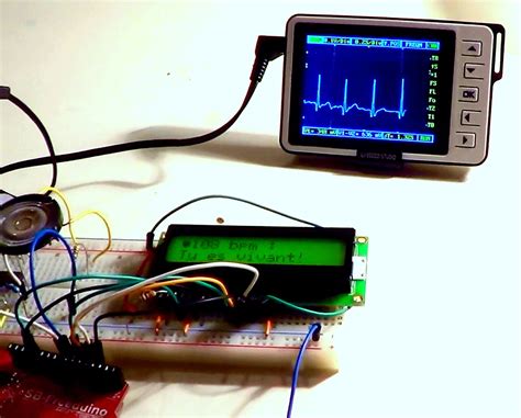 Electrocardiograph And Heart Rate Monitor Diy Project