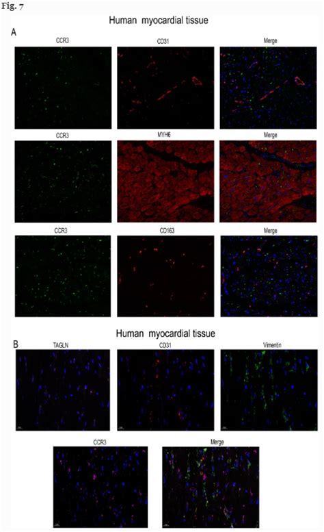 Ccl24ccr3轴通过刺激m2型巨噬细胞极化和成纤维细胞活化在ang Ii诱导的心力衰竭中发挥核心作用 知乎