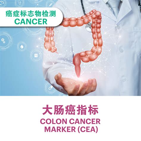 Cea Test Colorectal Cancer Tumor Marker And Monitoring Prinz Healthcare