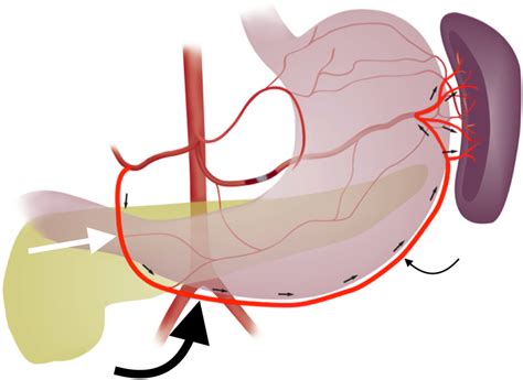 Left Gastroepiploic Artery Pacs