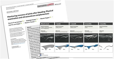 Floor Flora Van Leeuwen On Linkedin The 4th Paper Of My Phd Was Published Today In