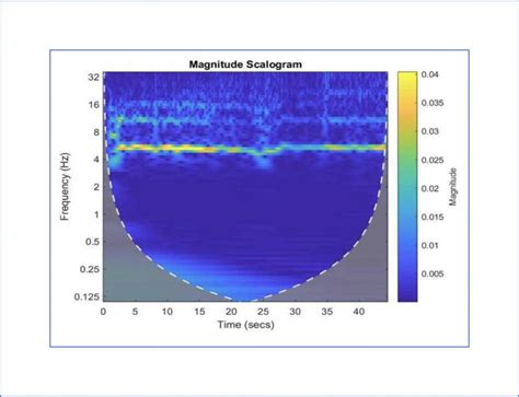 Continuous Wavelet Transform Cwt Of A Mild Tremor Simulated By A