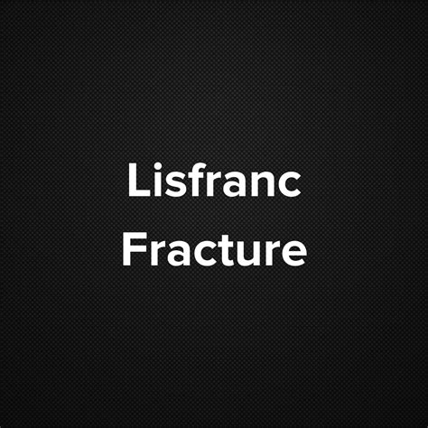 Lisfranc Fracture Moho