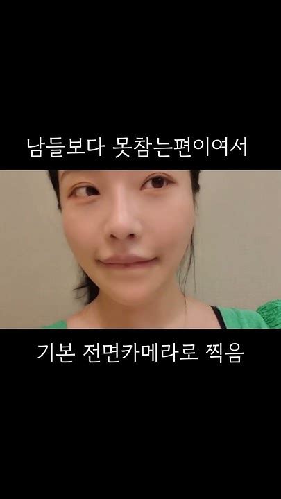 티타늄리프팅 일주일차 후기 Youtube