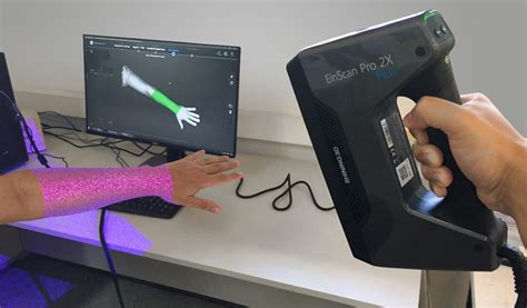 3d Printed Arm Prosthesis On Behance