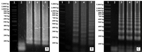 Optimization Of Rt Lamp Reaction Conditions For The Detection Of Zymv