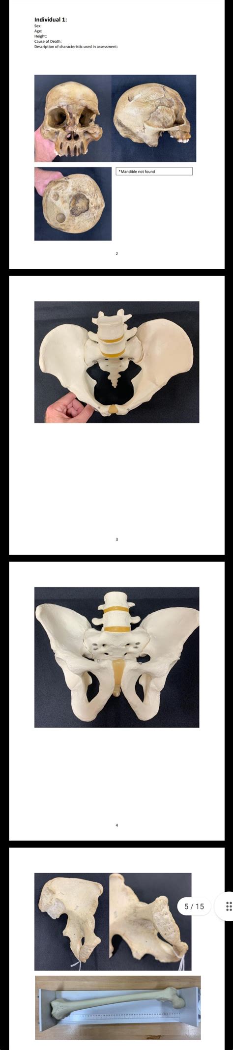 Solved Estimate The Age Sex And Any Other Information From Chegg Com